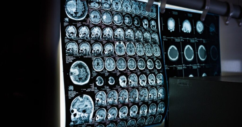 Medical Imaging Explained: A Guide and Detailed Exploration