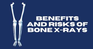 Bone X-rays: How They Work, Procedure, and What to Expect
