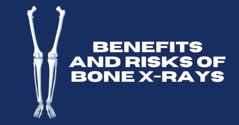 Bone X-rays: How They Work, Procedure, and What to Expect
