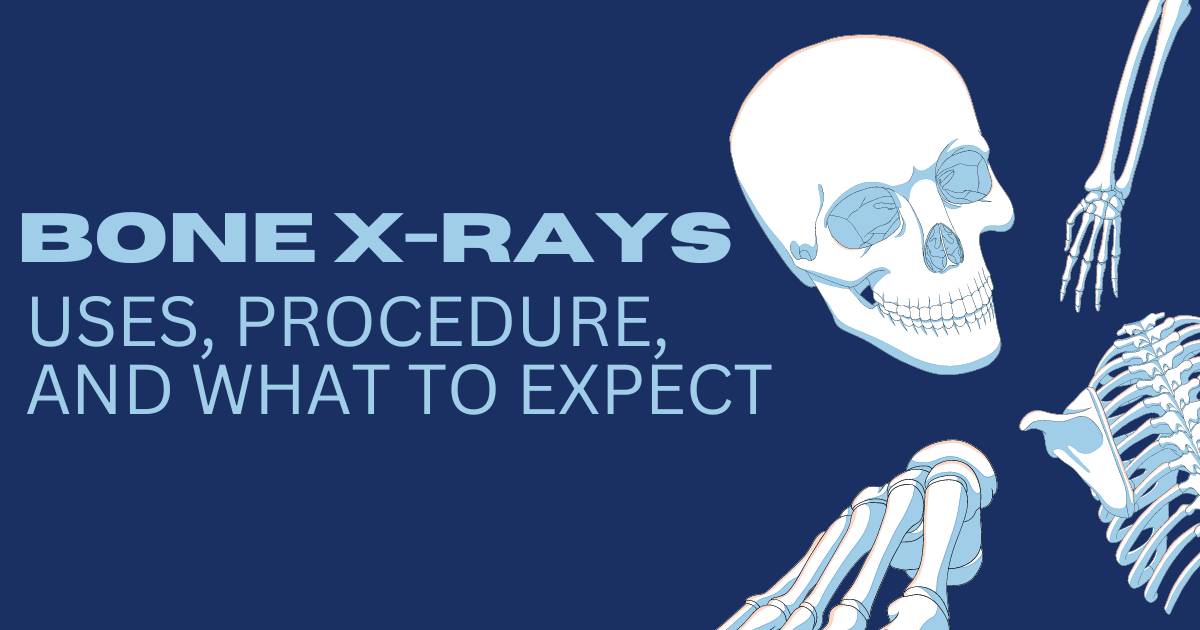 Bone X-rays: How They Work, Procedure, and What to Expect