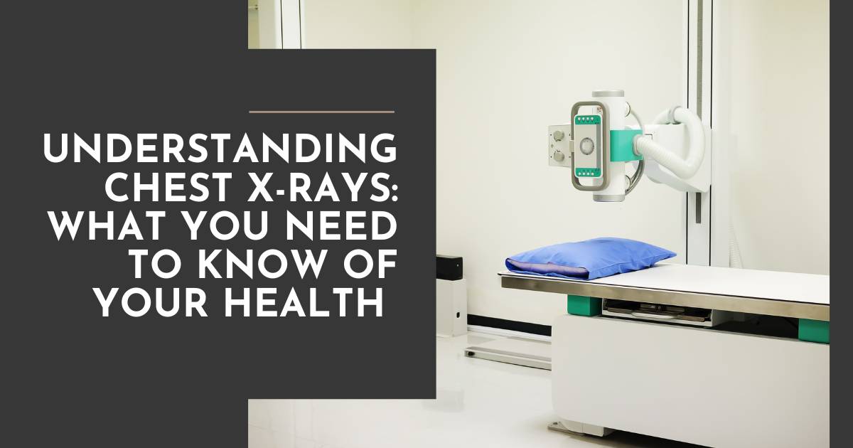 Chest X-Rays Explained: Key Facts You Need to Know | SBS